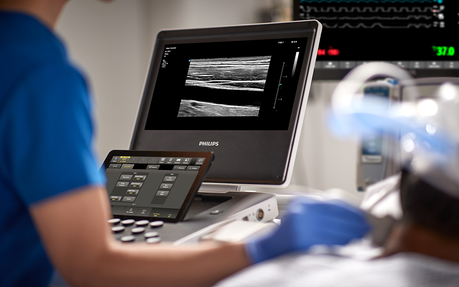 Philips launches healthcare innovations at Global Health 2023 in Saudi ...